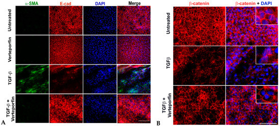 Understanding the Role of Yes-Associated Protein (YAP) Signaling in the ...