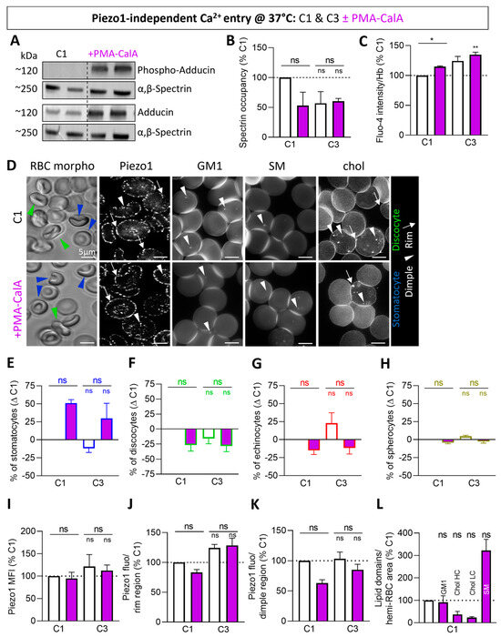 Piezo1 Regulation Involves Lipid Domains and the Cytoskeleton and Is ...