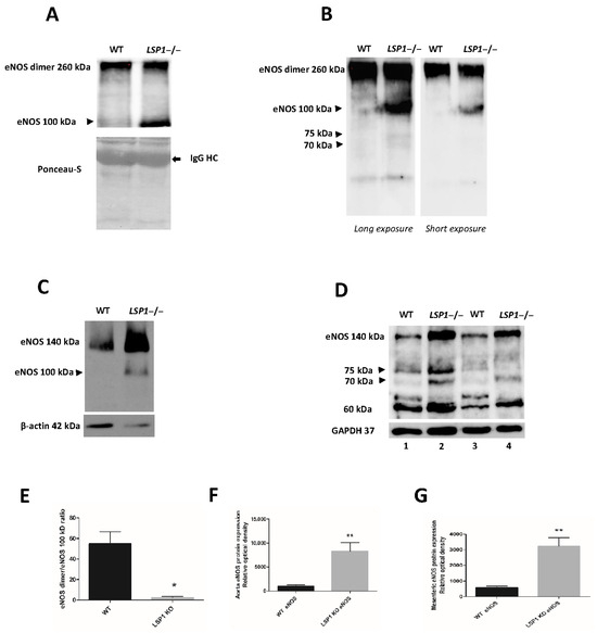 Lymphocyte-Specific Protein 1 Regulates Expression and Stability of ...
