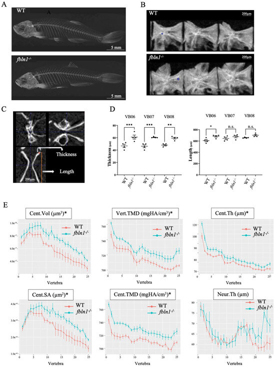 The Osteoblast Transcriptome in Developing Zebrafish Reveals Key Roles ...