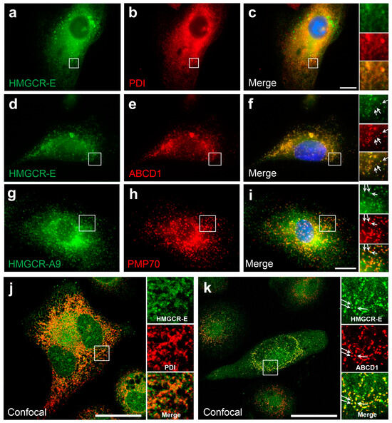 Peroxisomal Localization of a Truncated HMG-CoA Reductase under Low ...