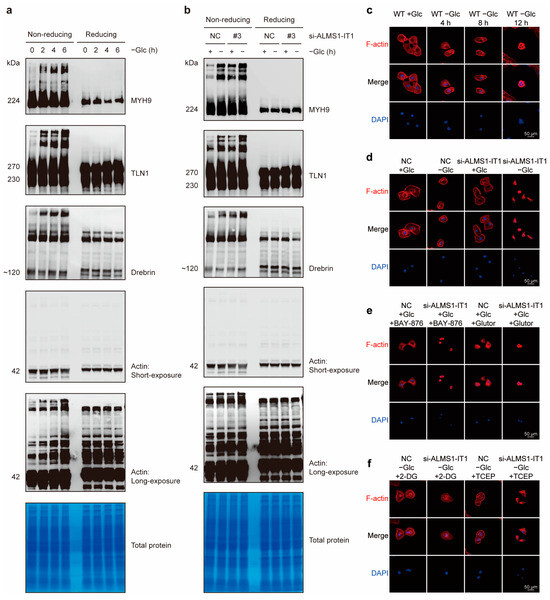 ALMS1-IT1: A Key Player in the Novel Disulfidptosis-Related LncRNA ...