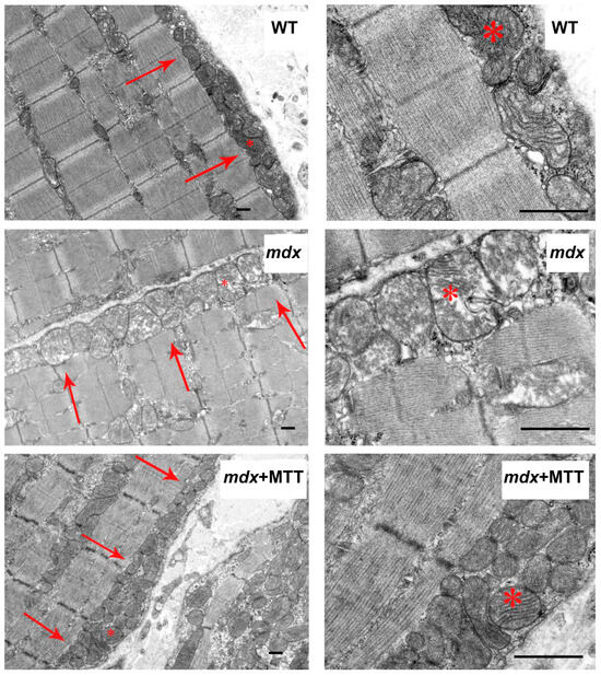 Mitochondrial Transplantation Therapy Ameliorates Muscular Dystrophy in ...