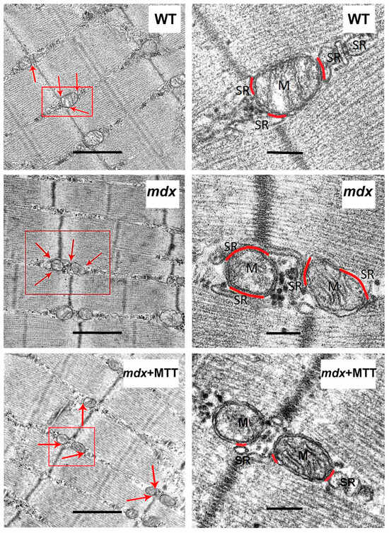 Mitochondrial Transplantation Therapy Ameliorates Muscular Dystrophy in ...