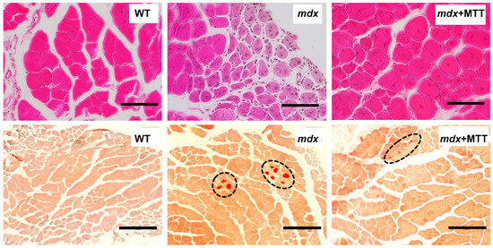 Mitochondrial Transplantation Therapy Ameliorates Muscular Dystrophy in ...