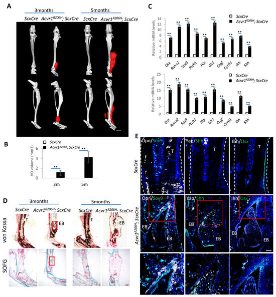 Hedgehog Signaling Controls Chondrogenesis and Ectopic Bone Formation ...