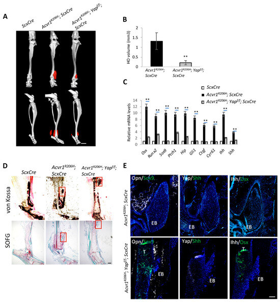 Hedgehog Signaling Controls Chondrogenesis and Ectopic Bone Formation ...