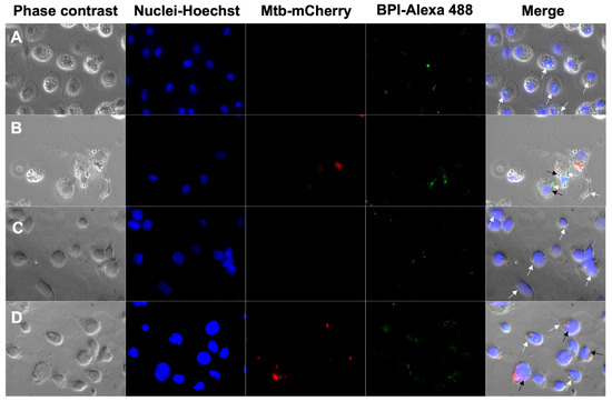 Bactericidal Permeability-Increasing Protein (BPI) Inhibits ...