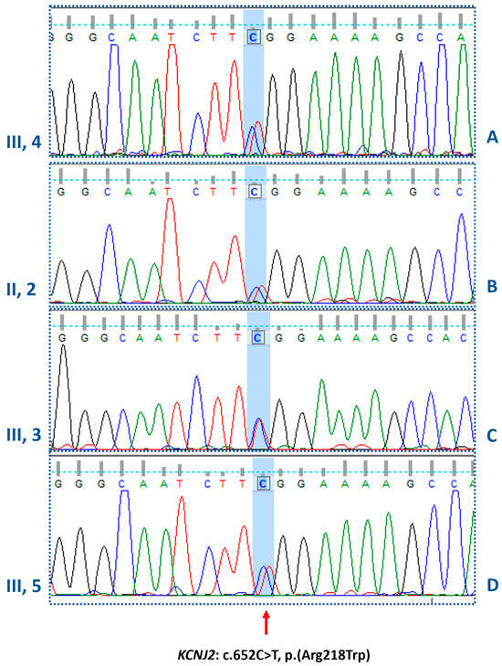Phenotypic Variability of Andersen–Tawil Syndrome Due to Allelic ...