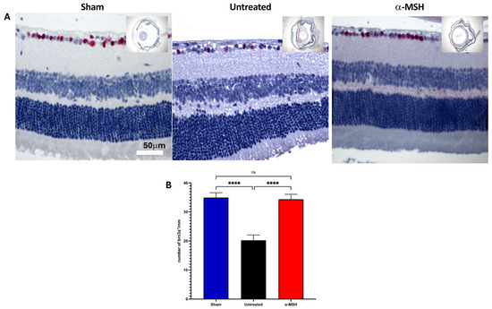 Alpha-Melanocyte-Stimulating Hormone Maintains Retinal Homeostasis ...