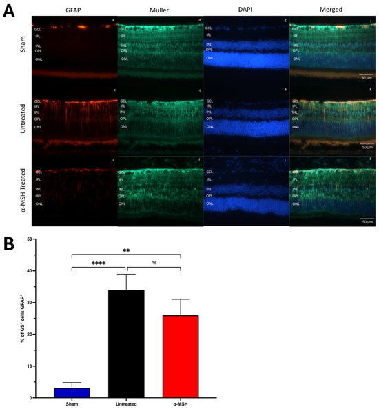 Alpha-Melanocyte-Stimulating Hormone Maintains Retinal Homeostasis ...