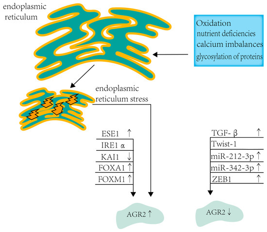 AGR2: The Covert Driver and New Dawn of Hepatobiliary and Pancreatic Cancer Treatment