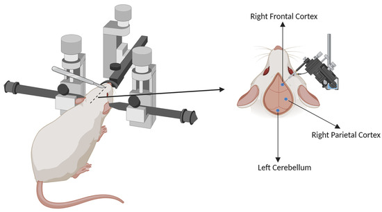 Glial Response and Neuronal Modulation Induced by Epidural Electrode ...