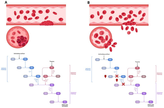 Recent Advances in Gene Therapy for Hemophilia: Projecting the Perspectives