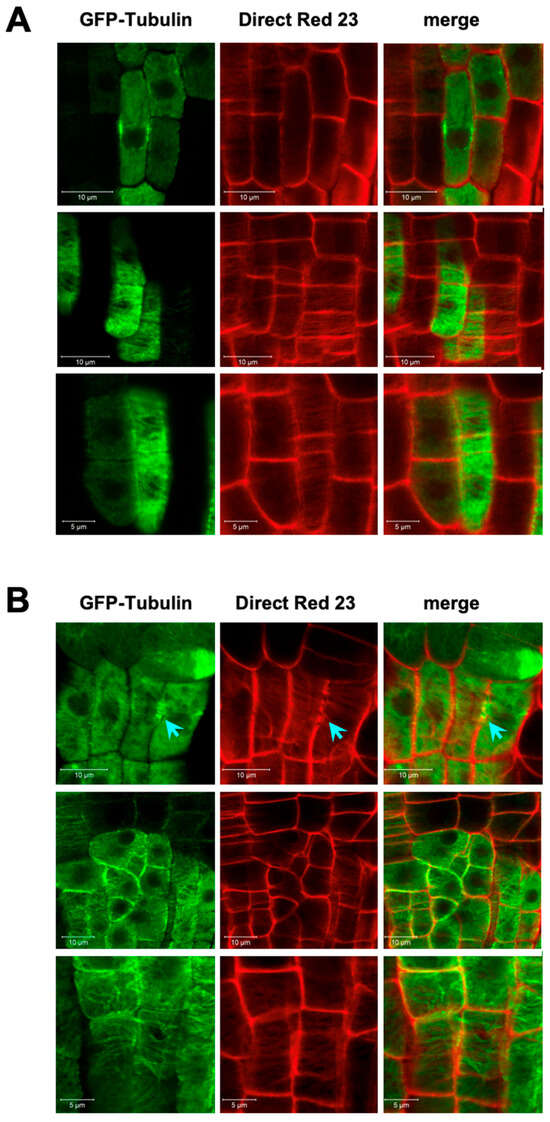 Characterization of Subcellular Dynamics of Sterol Methyltransferases ...