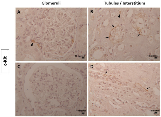 Immunohistochemical and Ultrastructural Characterization of Telocytes ...