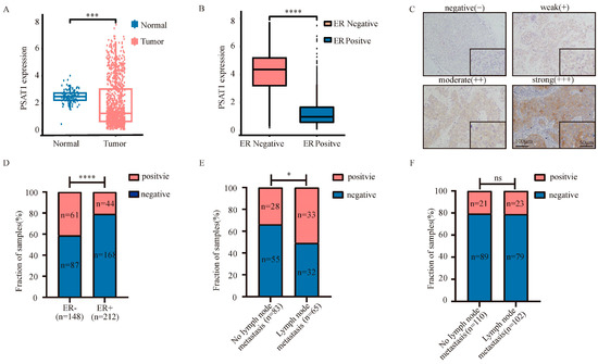 PSAT1 Promotes Metastasis via p-AKT/SP1/ITGA2 Axis in Estrogen Receptor ...