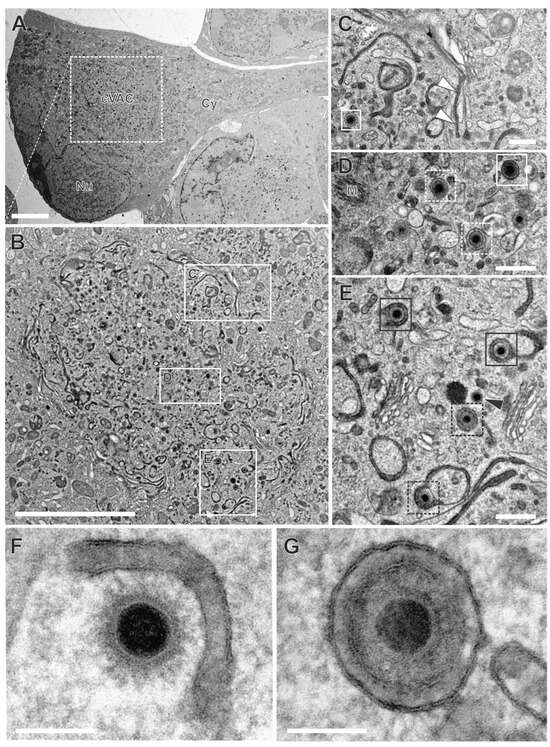 Secondary Envelopment of Human Cytomegalovirus Is a Fast Process ...