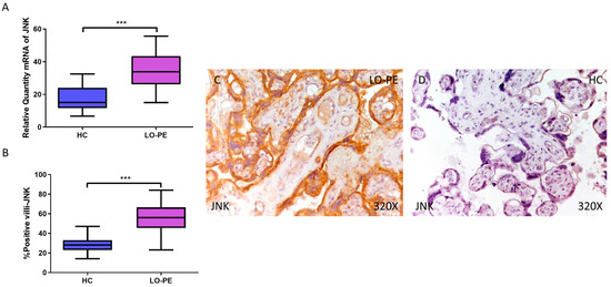 Placental Tissue Calcification and Its Molecular Pathways in Female ...