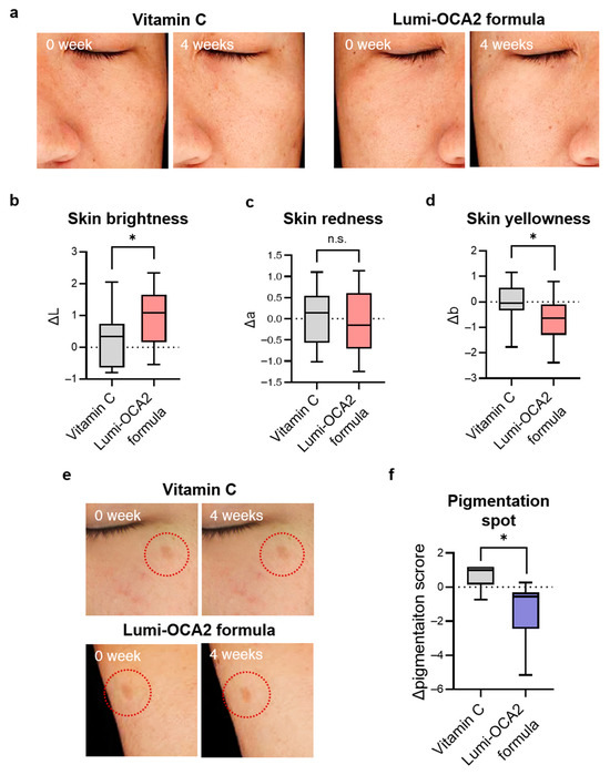 Modulating OCA2 Expression as a Promising Approach to Enhance Skin ...