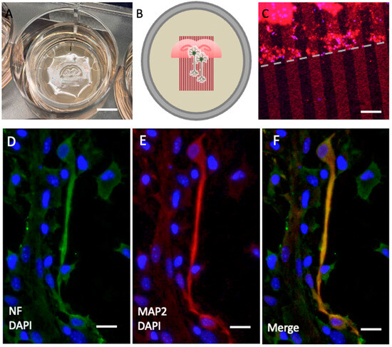 From Organotypic Mouse Brain Slices to Human Alzheimer’s Plasma ...