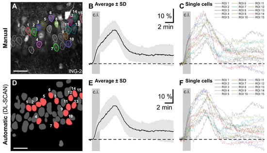 Deep-Learning-Based Segmentation of Cells and Analysis (DL-SCAN)