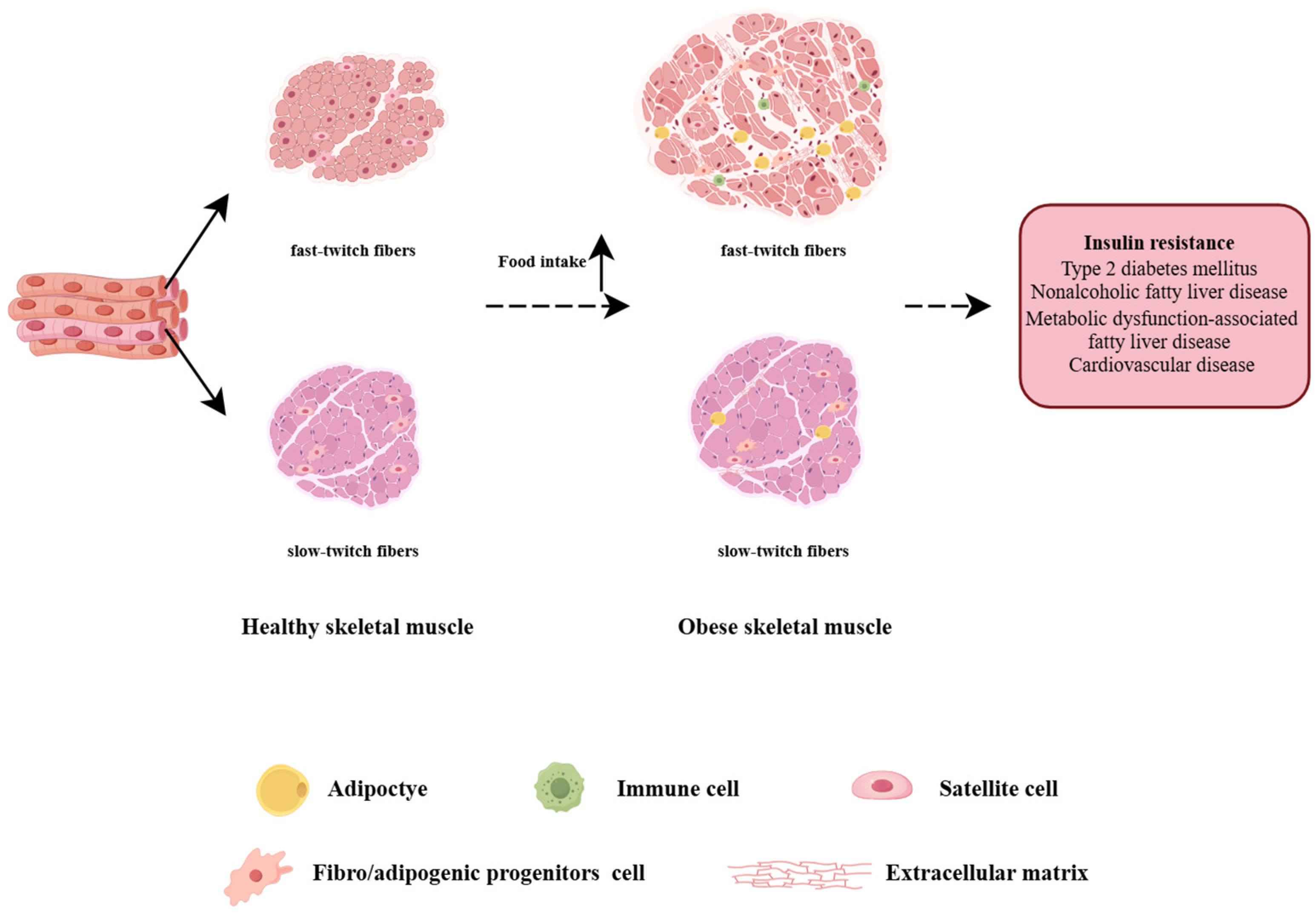 The Change of Skeletal Muscle Caused by Inflammation in Obesity as the ...