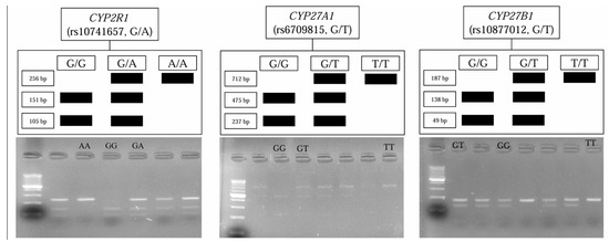 Genetic Polymorphism of CYP2R1, CYP27A1, CYP27B1, and Vitamin D ...