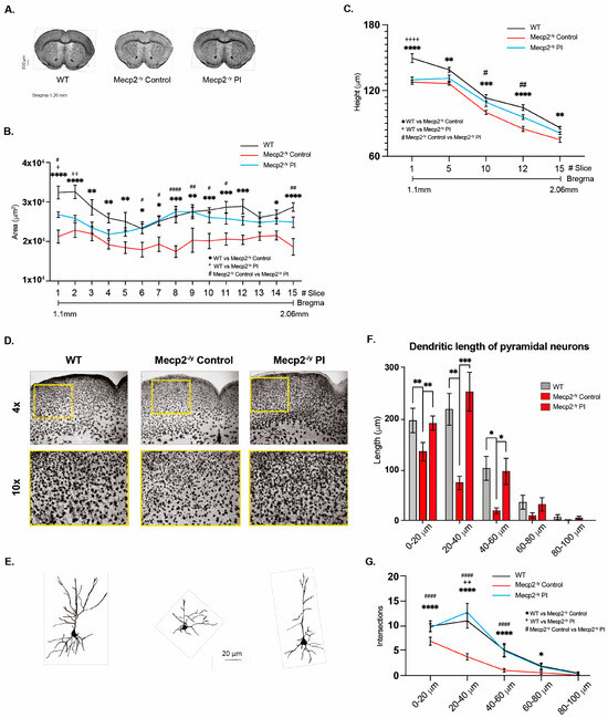 Neuronal Plasticity-Dependent Paradigm and Young Plasma Treatment ...