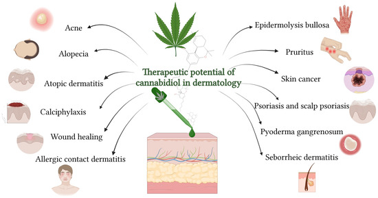 Cannabidiol in Skin Health: A Comprehensive Review of Topical Applications in Dermatology and ...