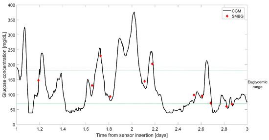 Calibration of Minimally Invasive Continuous Glucose Monitoring Sensors ...