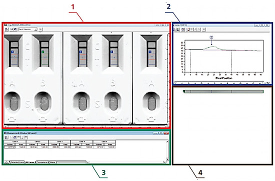 Towards Lateral Flow Quantitative Assays: Detection Approaches