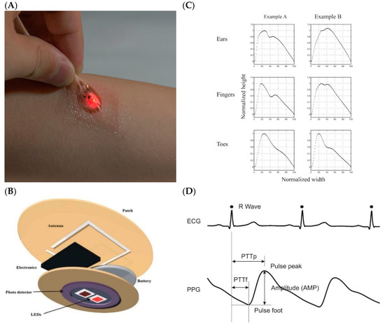 Wearable Skin Sensors and Their Challenges: A Review of Transdermal ...