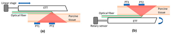 Real-Time Optical Monitoring of Endotracheal Tube Displacement