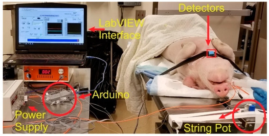 Real-Time Optical Monitoring of Endotracheal Tube Displacement