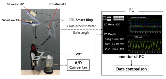 Development of Smart-Ring-Based Chest Compression Depth Feedback Device for High Quality Chest ...