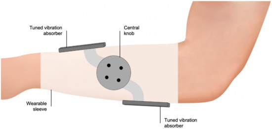 Medical Devices for Tremor Suppression: Current Status and Future ...