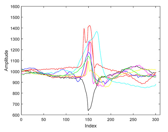 On the Classification of ECG and EEG Signals with Various Degrees of Dimensionality Reduction