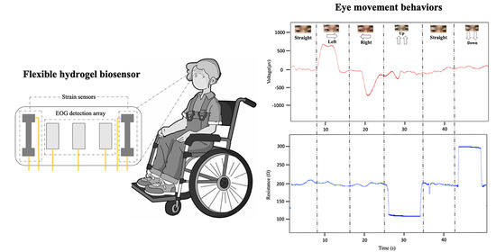 Biosensors | Free Full-Text | Eye-Movement-Controlled Wheelchair Based ...
