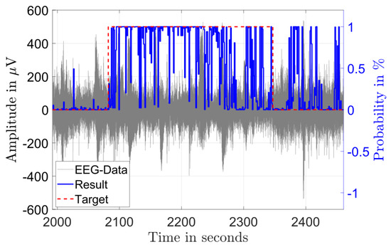 Biosensors | Free Full-Text | Epileptic Seizure Detection on an Ultra ...