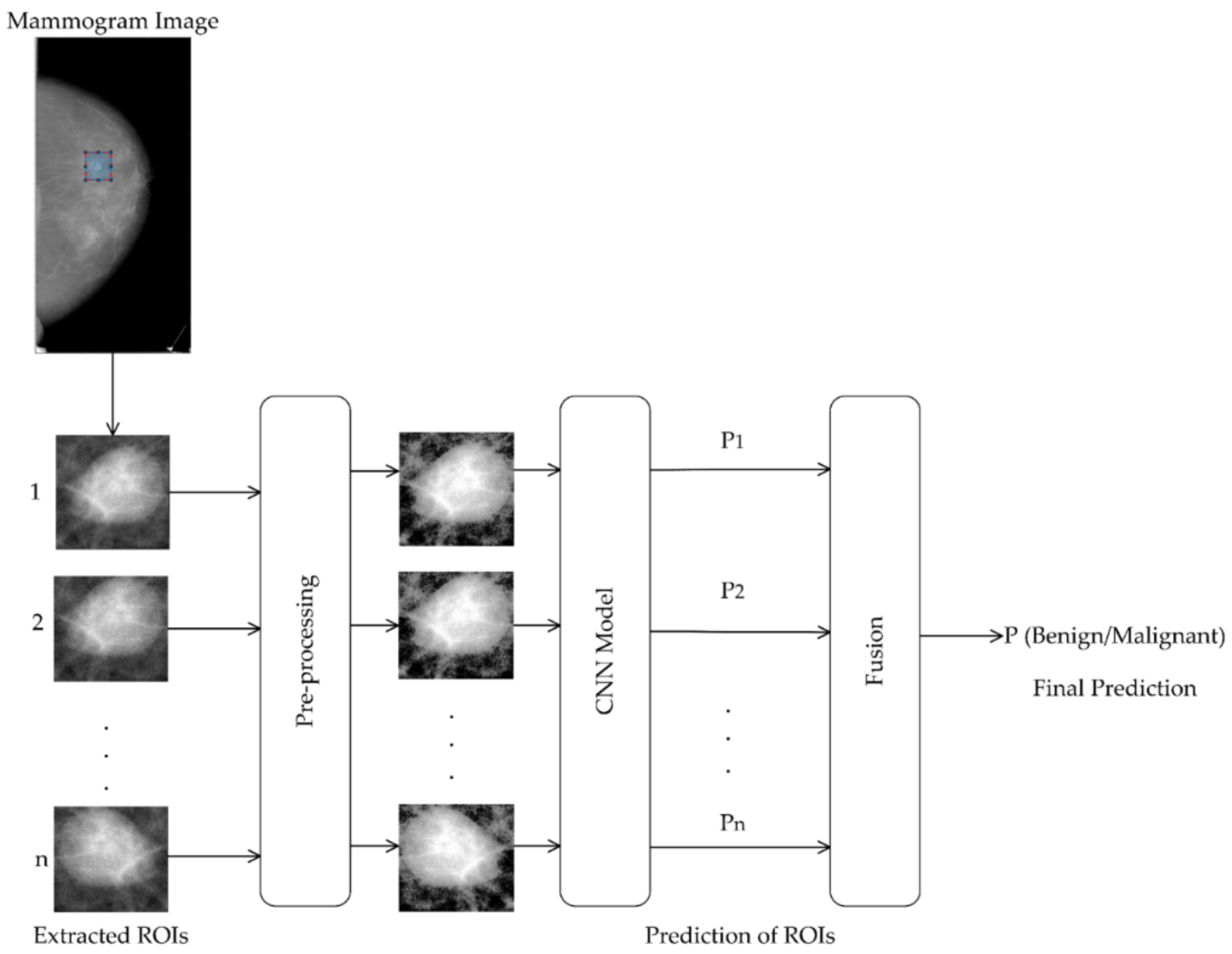 Breast Mass Classification Using Diverse Contextual Information and ...