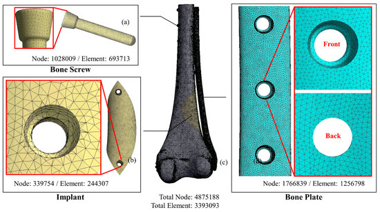 Biomechanical Analysis and Design Method for Patient-Specific ...