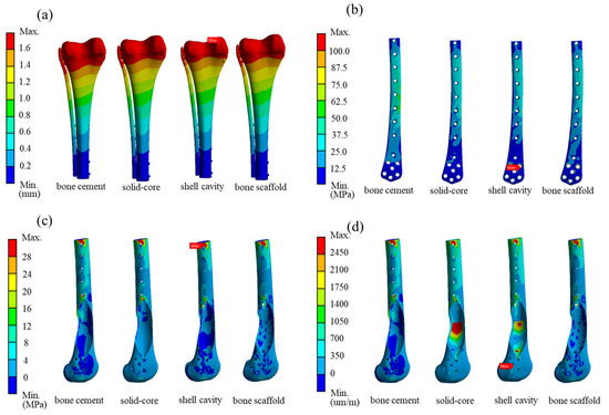 Biomechanical Analysis and Design Method for Patient-Specific ...