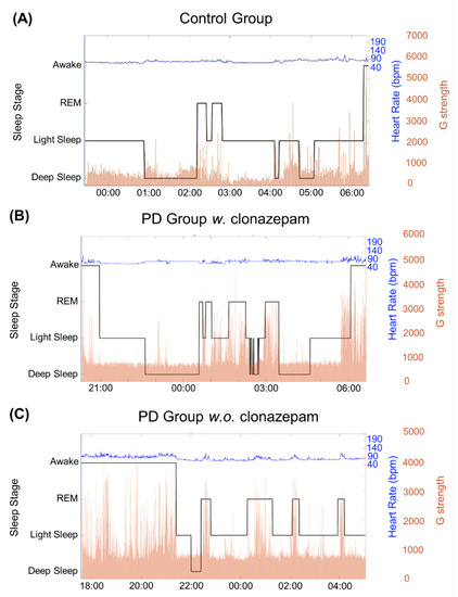 Biosensors | Free Full-Text | Quantification Analysis of Sleep Based on ...