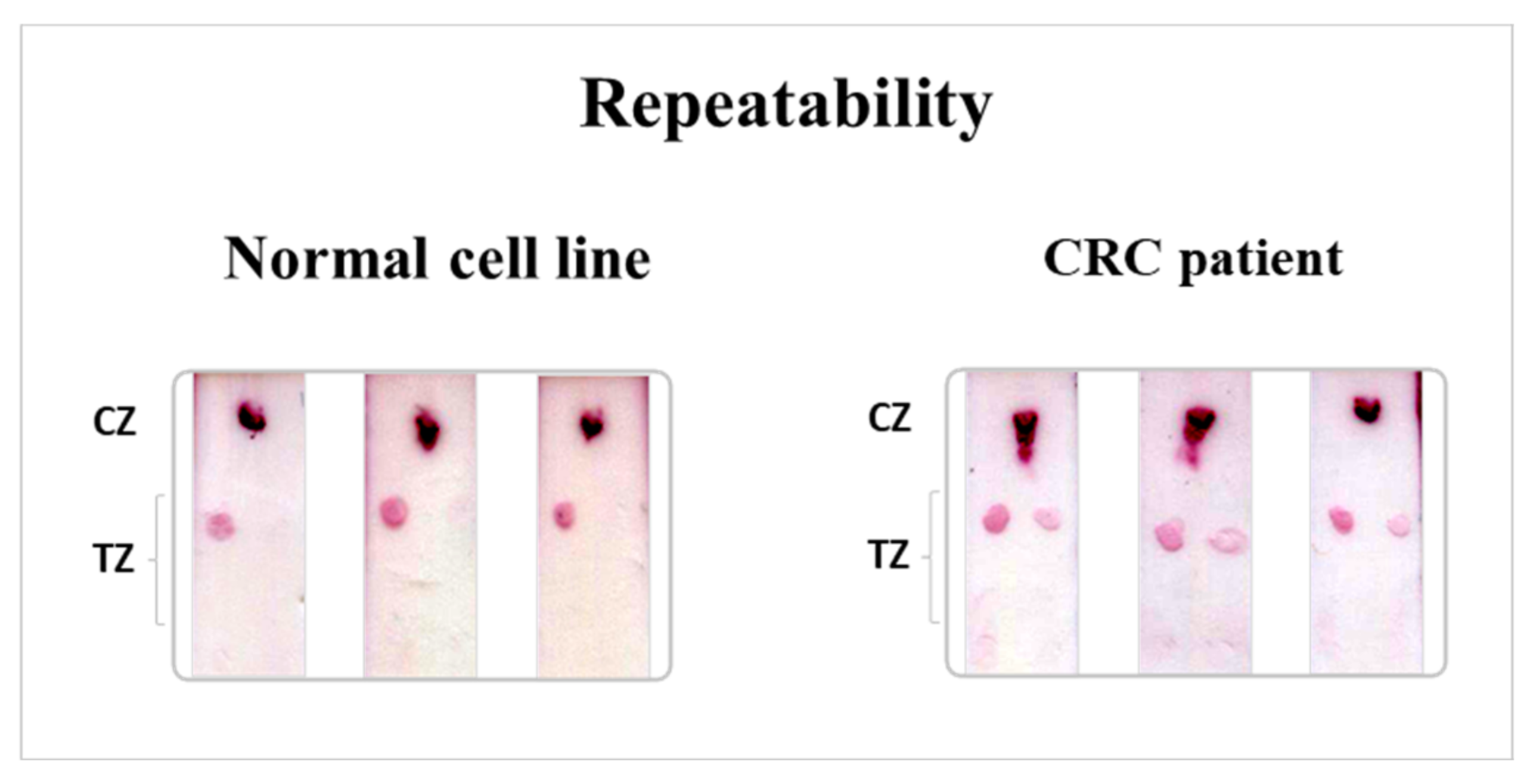 Rapid Multiplex Strip Test for the Detection of Circulating Tumor DNA ...