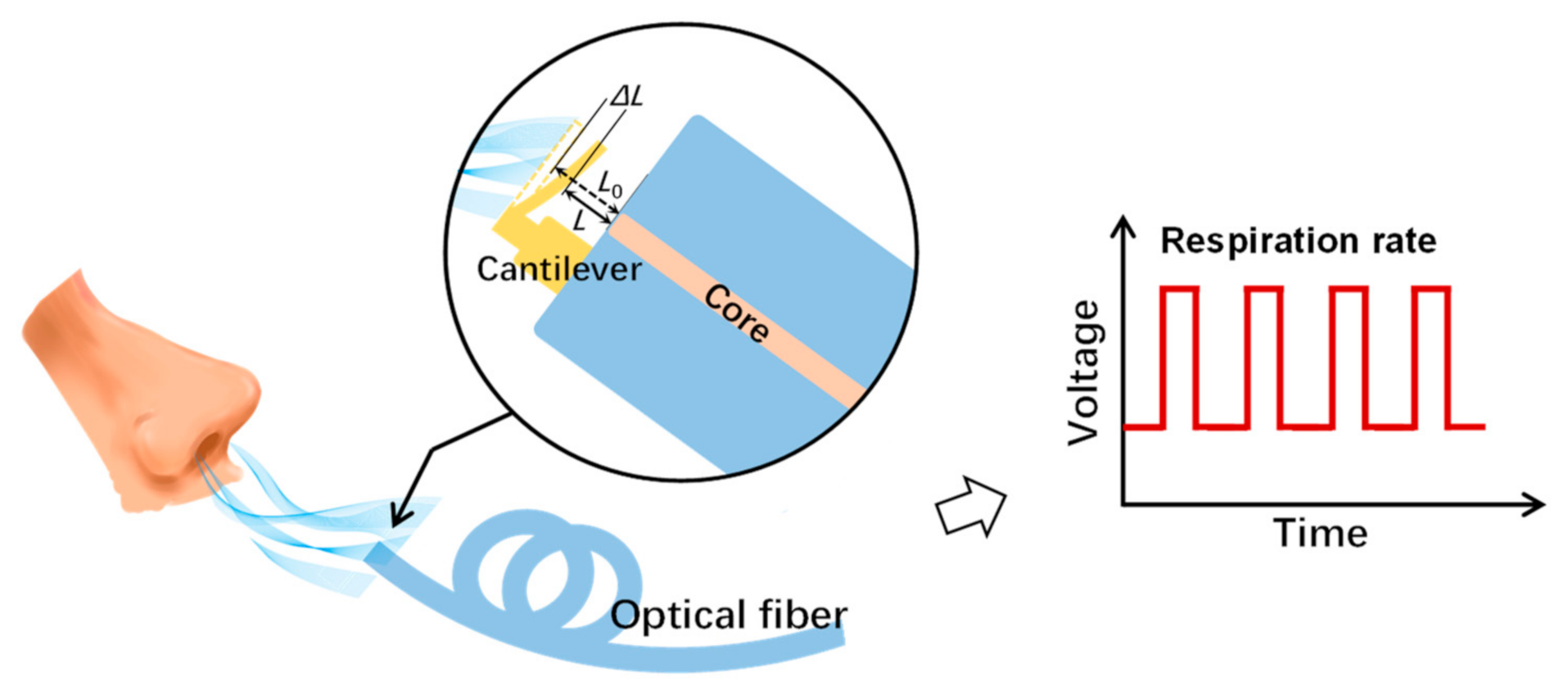 A Wearable Breath Sensor Based on Fiber-Tip Microcantilever
