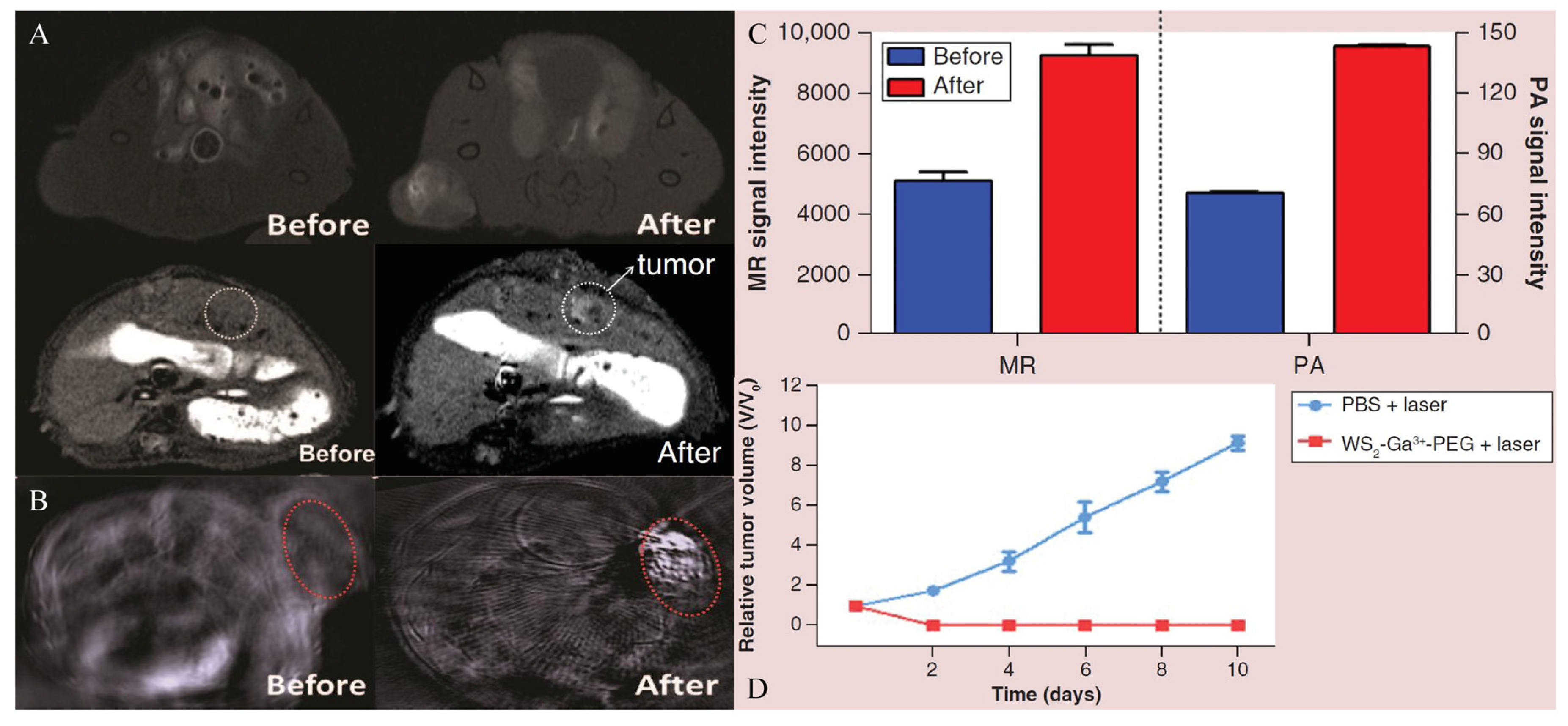 Targeted Molecular Imaging Probes Based on Magnetic Resonance Imaging ...