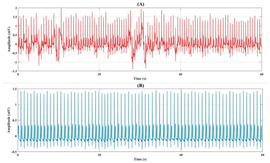 Biosensors | Free Full-Text | Wearable Flexible Electronics Based ...