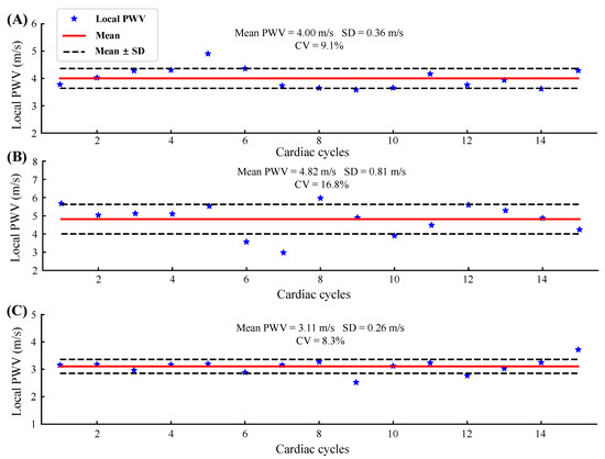 A Flexible Ultrasound Array for Local Pulse Wave Velocity Monitoring