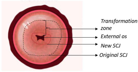 Cervical Imaging in the Low Resource Setting: A Review